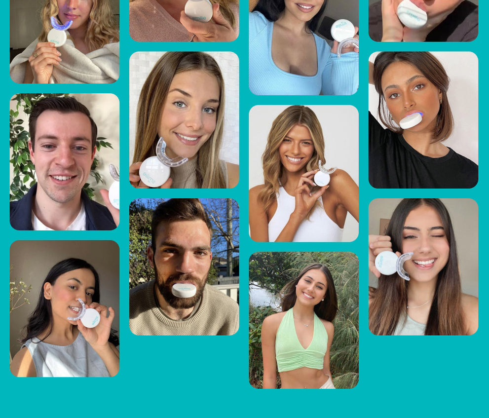 Smilie - #1 Dentist Formulated At-Home Kit!